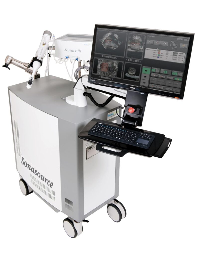 SonablateⓇ500 - タカイ医科工業