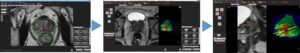 BioJet ™ 3D-MRI/TRUS Image Fusion Prostate Biopsy System - タカイ医科工業株式会社